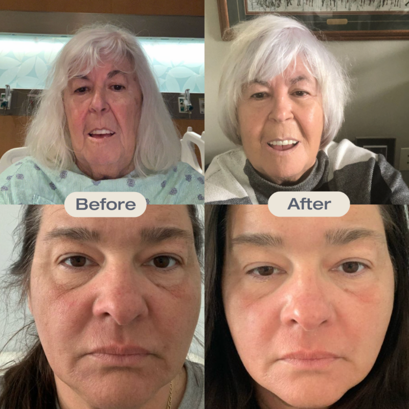 After Years of Resisting, I Finally Tried Hanacure’s Viral $29 Face ...