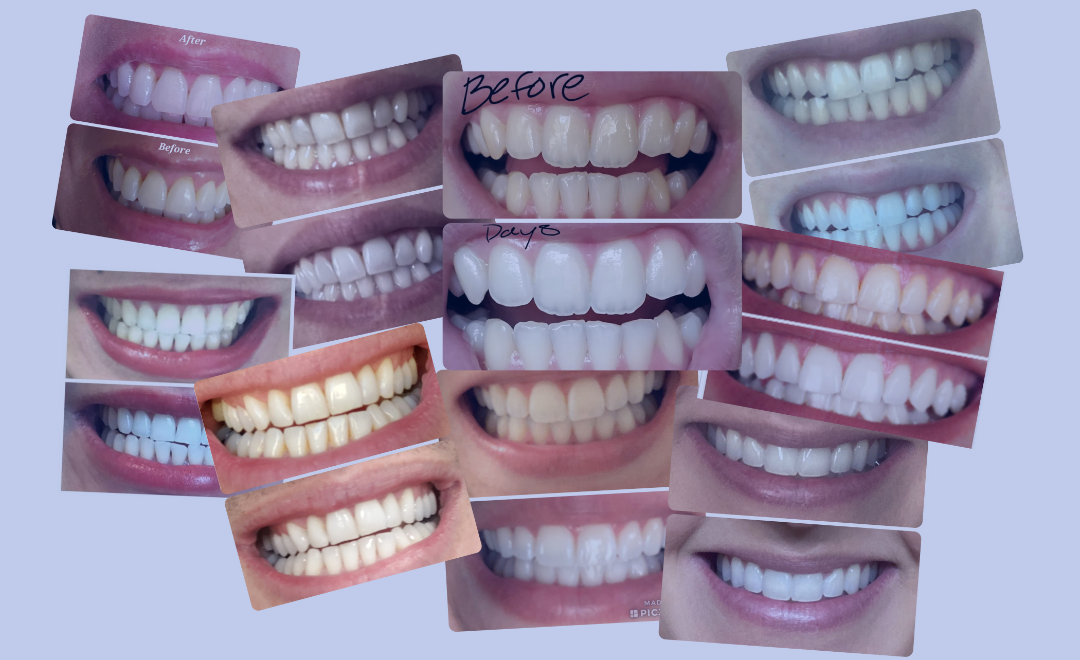 I Found The Secret To Whiter Teeth Without Sensitivity… - TheGetWell